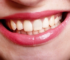 moons | Libera tu sonrisa desde casa